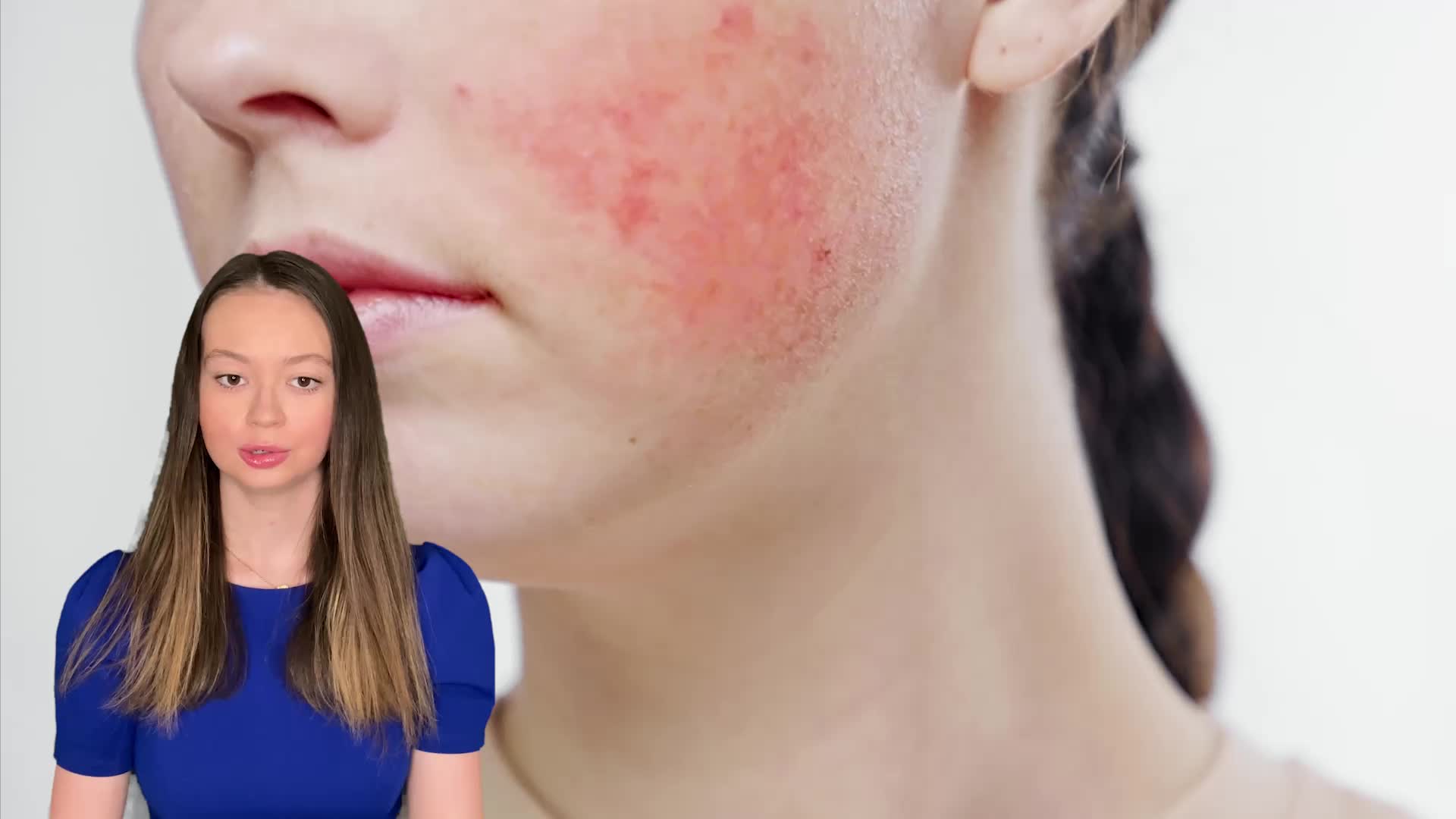 Skin Health News - Weather.com