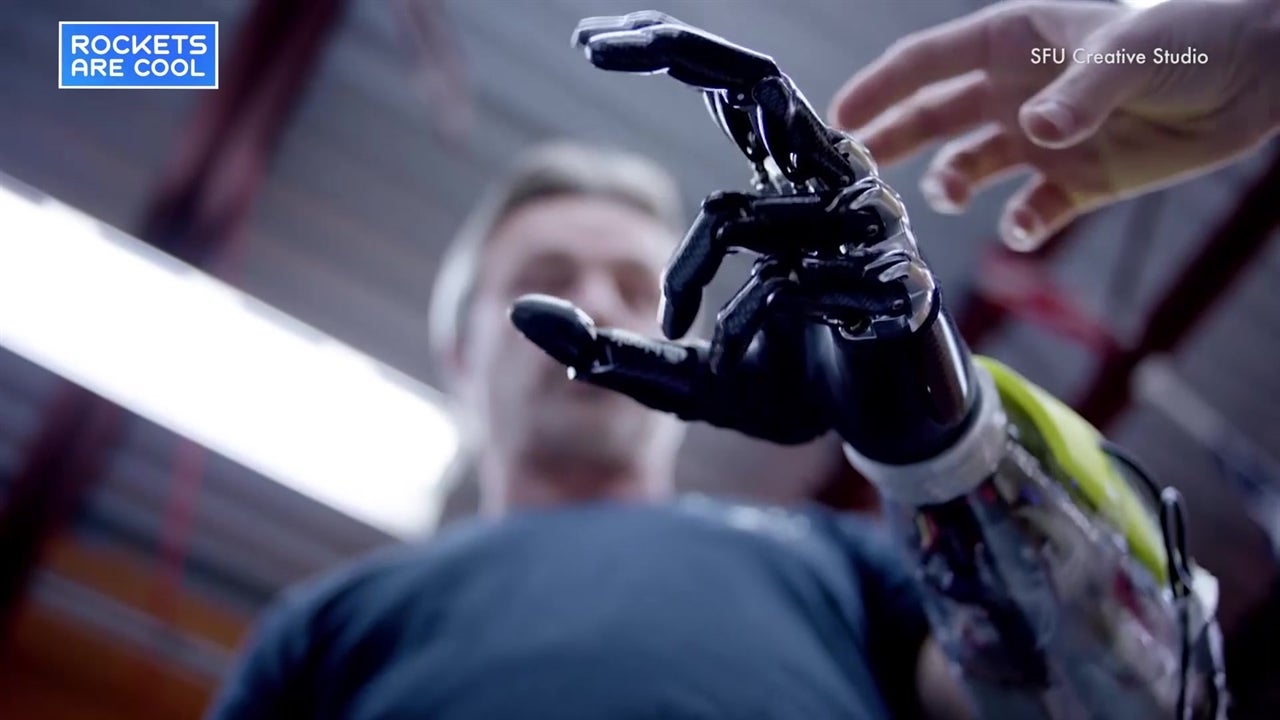 Parathlete Hoping for Better Bionic Hand - Videos from The Weather Channel
